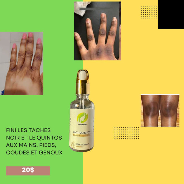 Nouveau Serum anti-quintos – Vraicop